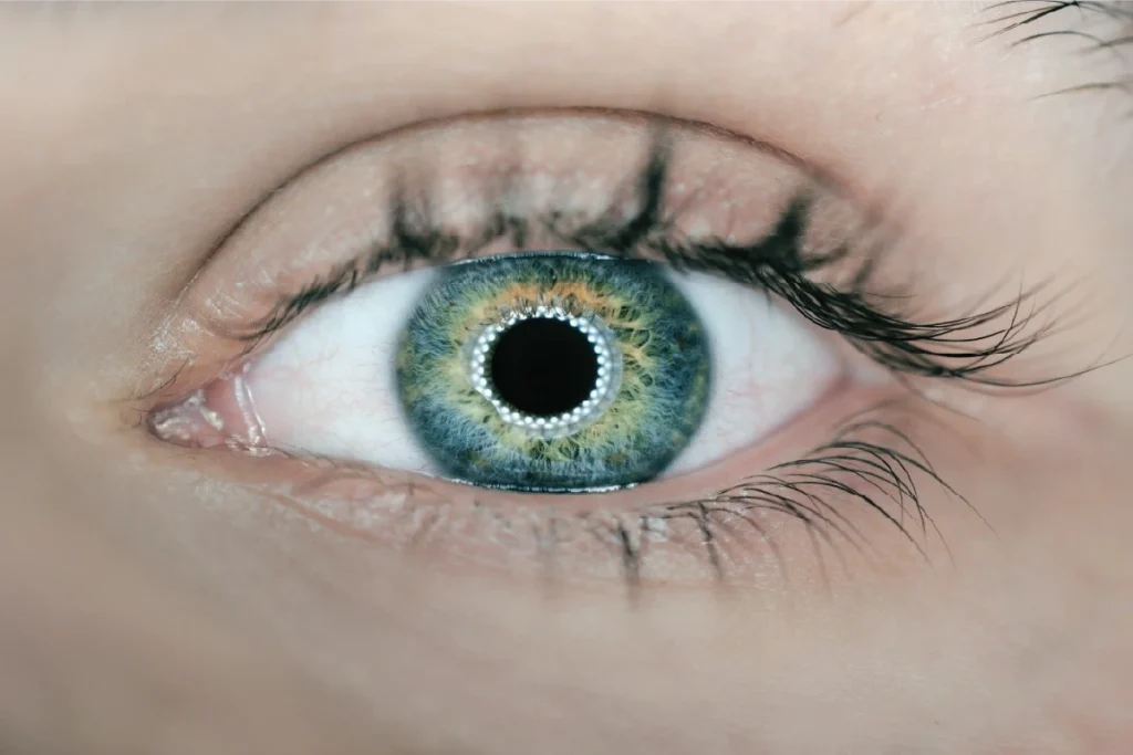 Articole oftalmologice - Relex Smile pro